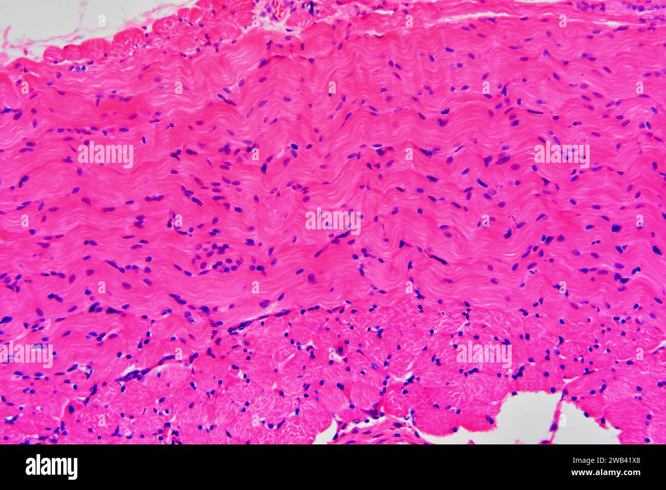 Smooth Muscle Longitudinal Section