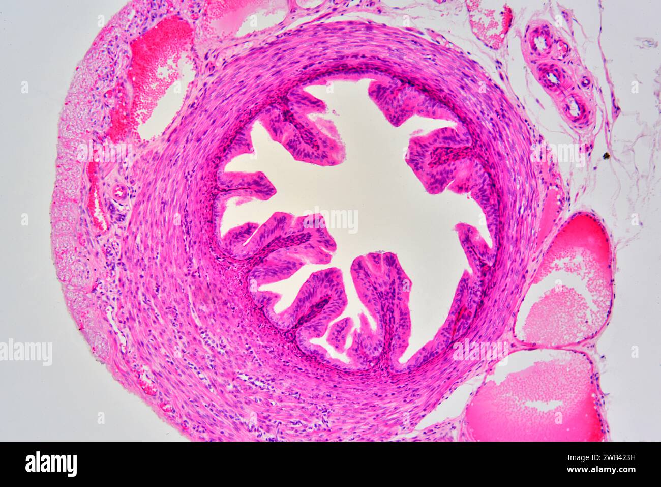 Falopian tube showing from outer to inner: serosa, subserosa, blood ...