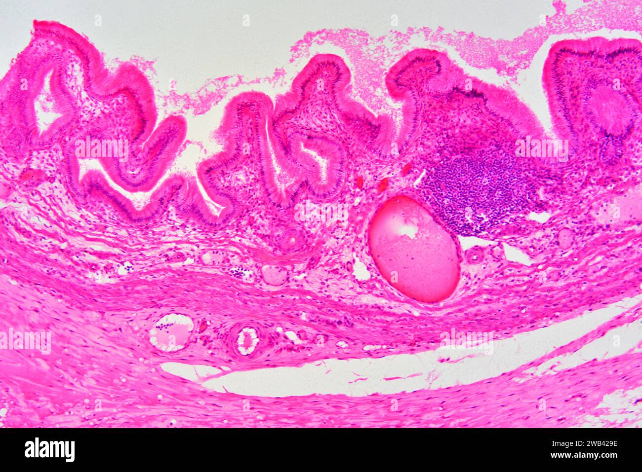 Gallbladder wall showing columnar epithelium with mucosal folds ...