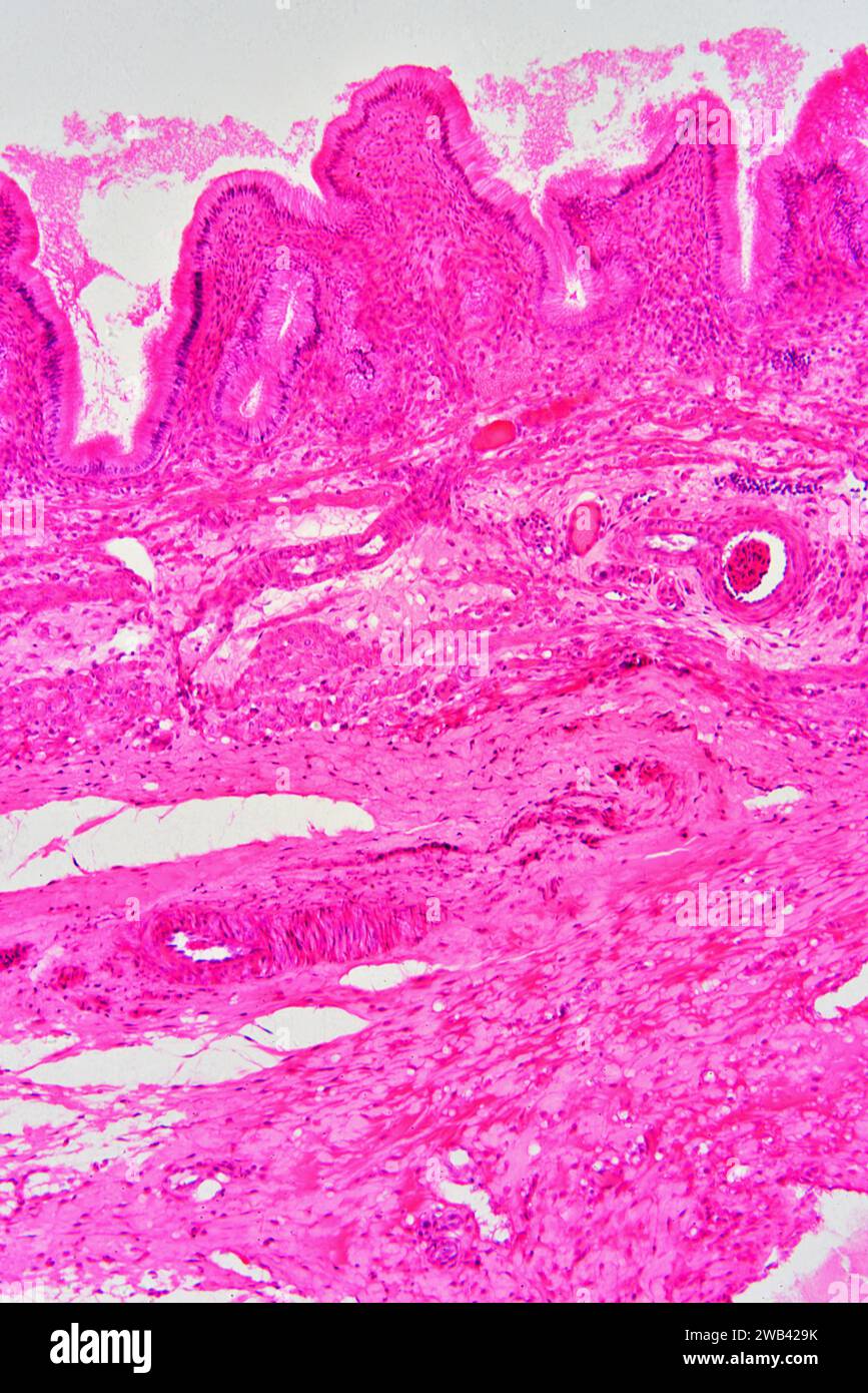 Gallbladder wall showing columnar epithelium with mucosal folds ...