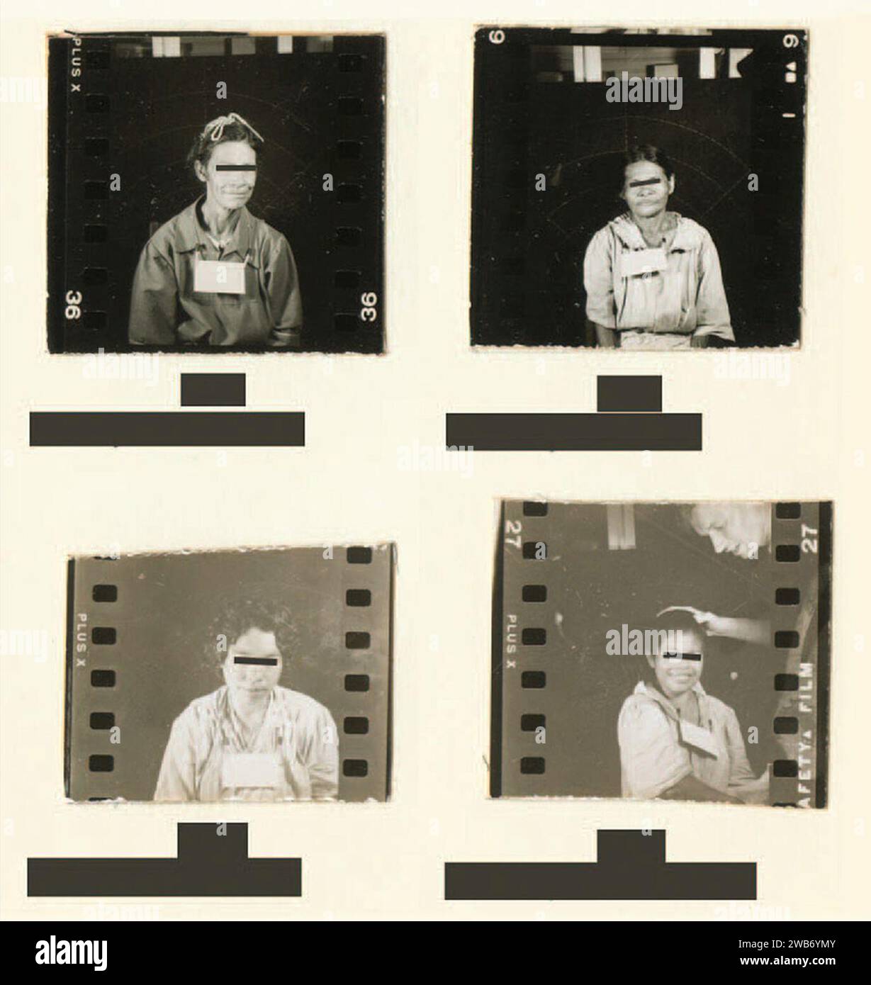 160223 SCI Guatemala-STD-Experiments-Victim-04-850px..CROP.original ...