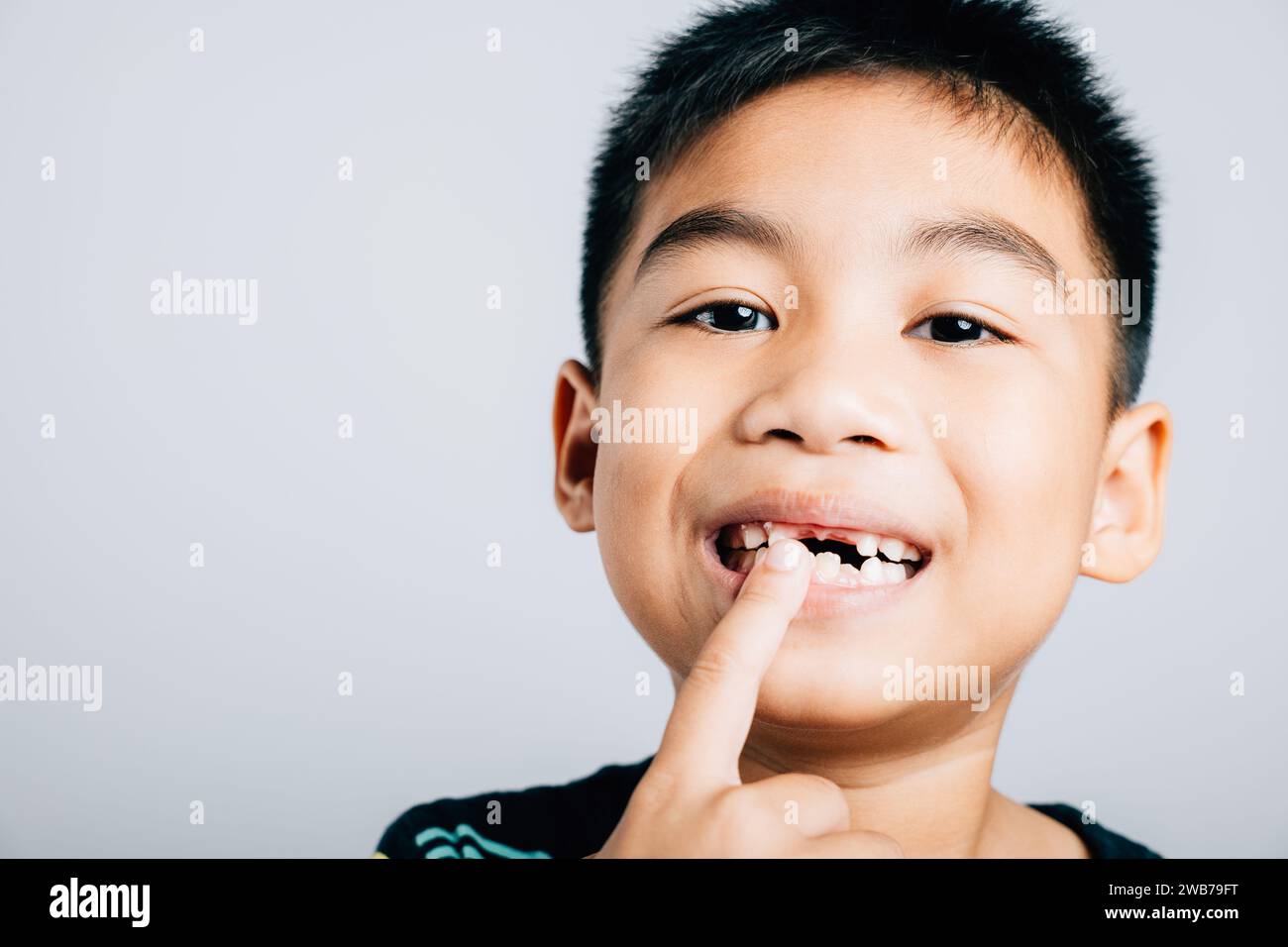 Asian kid showcases dental care by pointing to missing front tooth ...