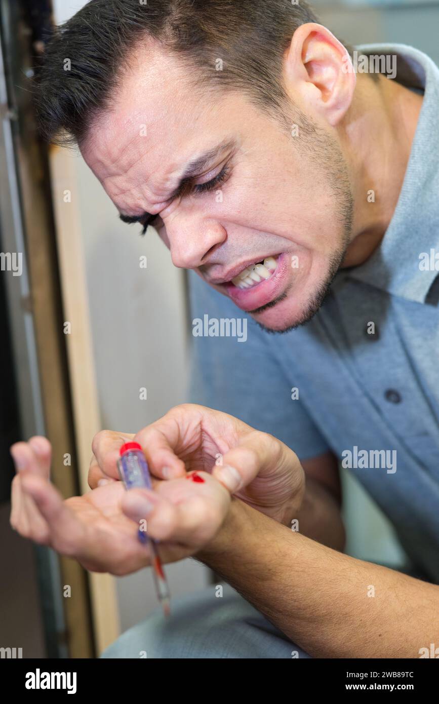 man cut his hand at work Stock Photo - Alamy
