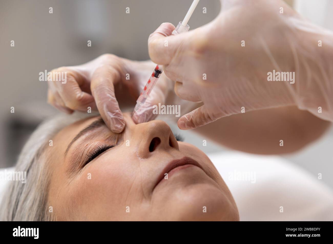 Beautician injecting filler into forehead of a female patient Stock ...