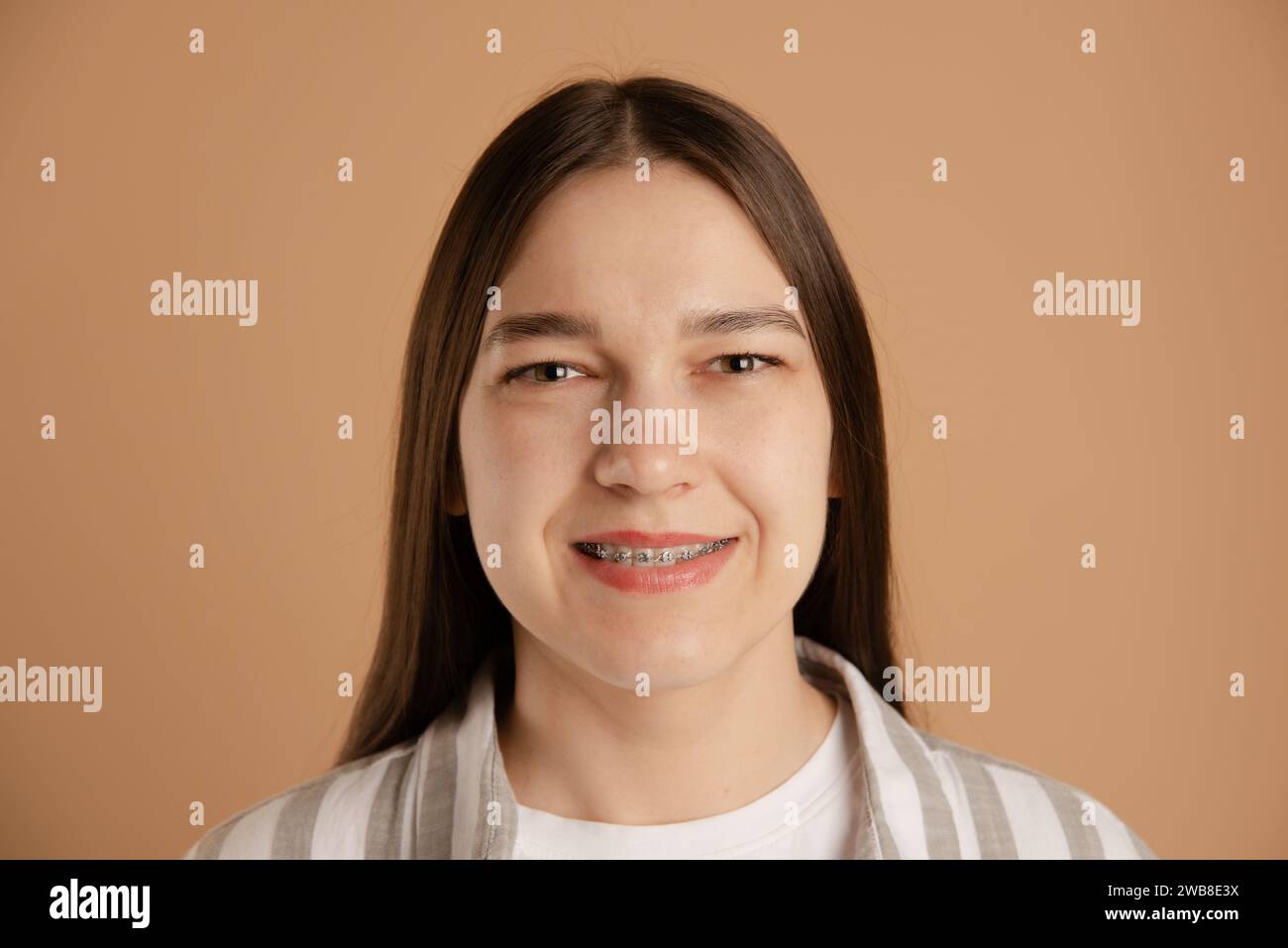 calm smiling girl with braces look at camera on beige background Stock ...