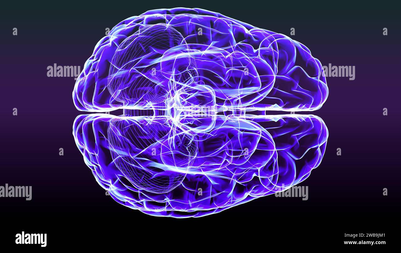 Section of a brain seen in profile, parts of the brain. Degenerative ...