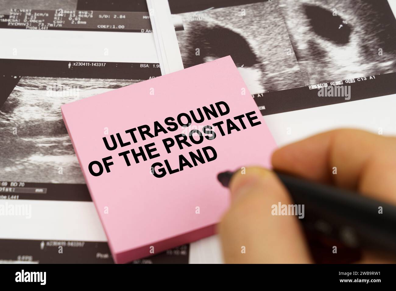 Medical concept. On the ultrasound pictures there are stickers that say ...