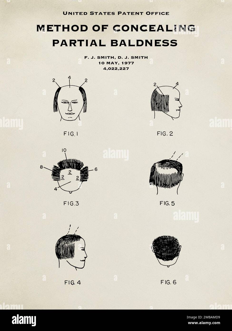 US patent design from 1977 for an unusual method to conceal baldness on ...