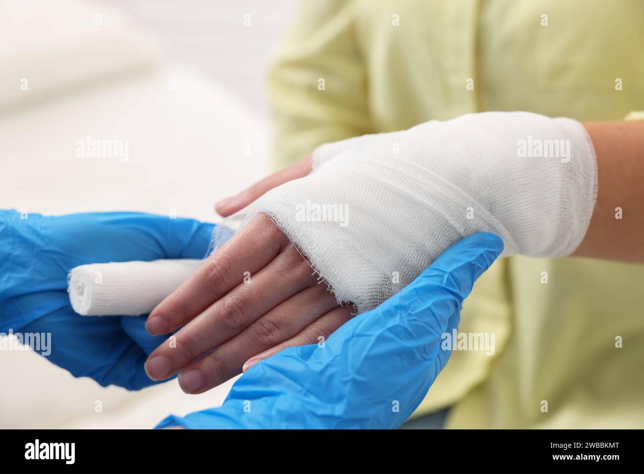 Doctor bandaging patient's burned hand indoors, closeup Stock Photo - Alamy