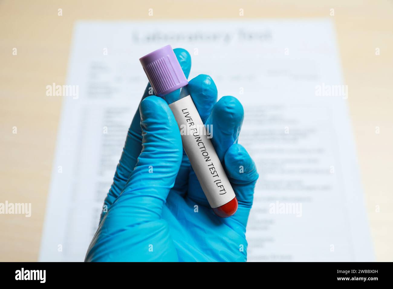 Laboratory worker holding tube with blood sample and label Liver ...