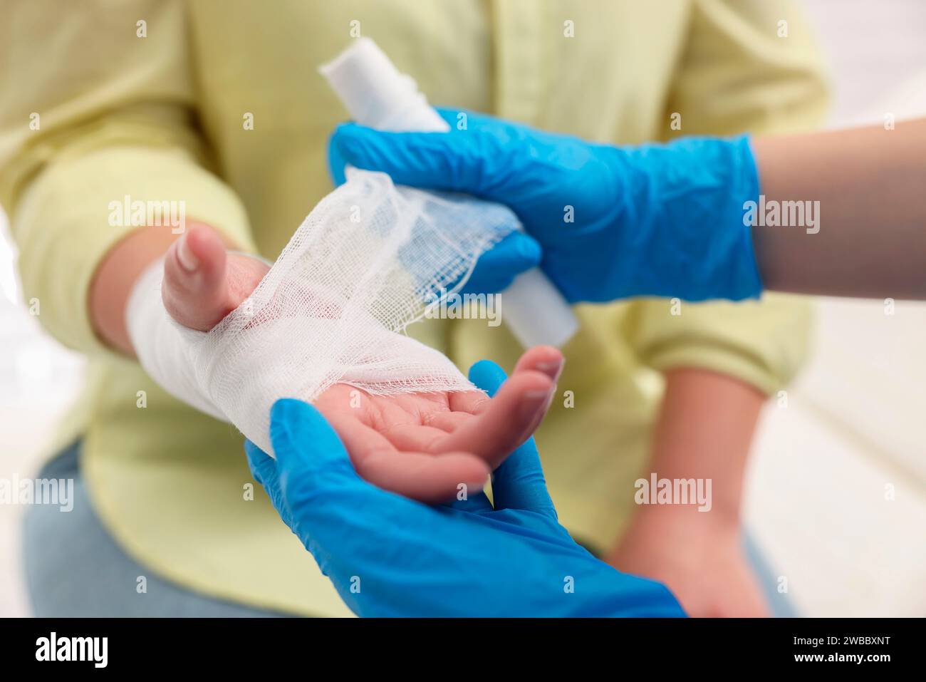 Doctor bandaging patient's burned hand indoors, closeup Stock Photo - Alamy