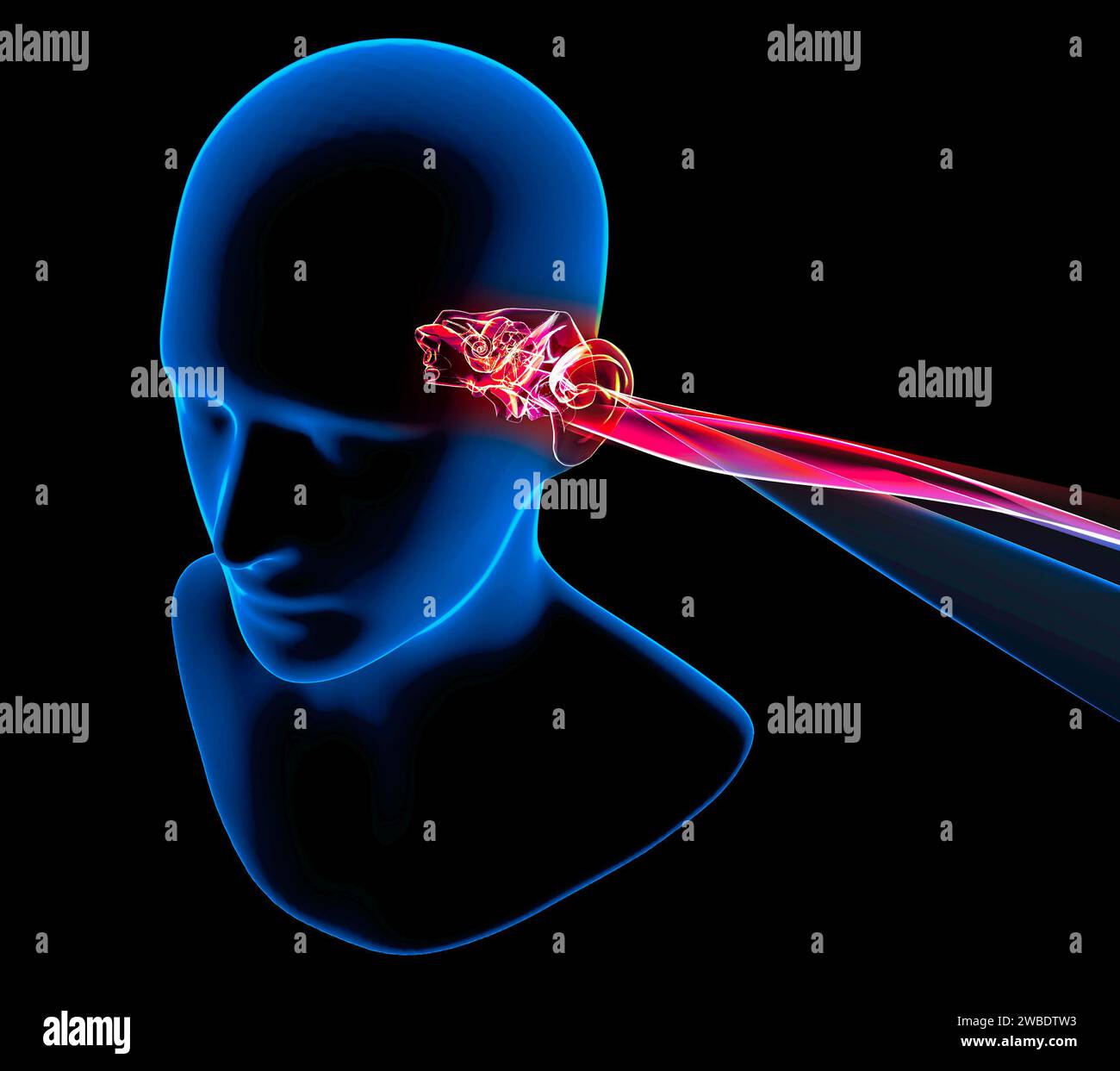 Hearing problems and solutions. Ultrasound. Deafness. Advancing age and ...