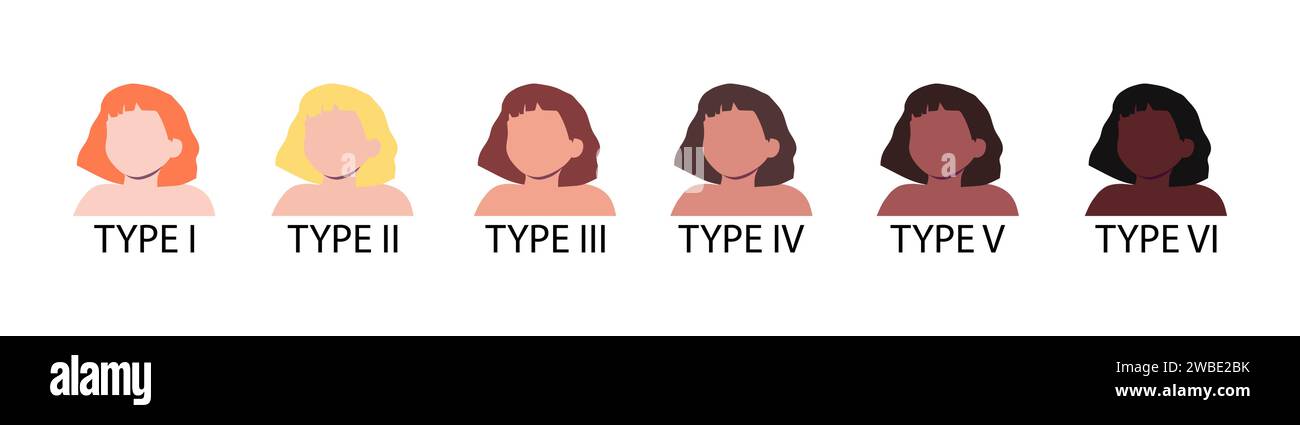 Fitzpatrick scale skin types infographic vector illustration Stock ...