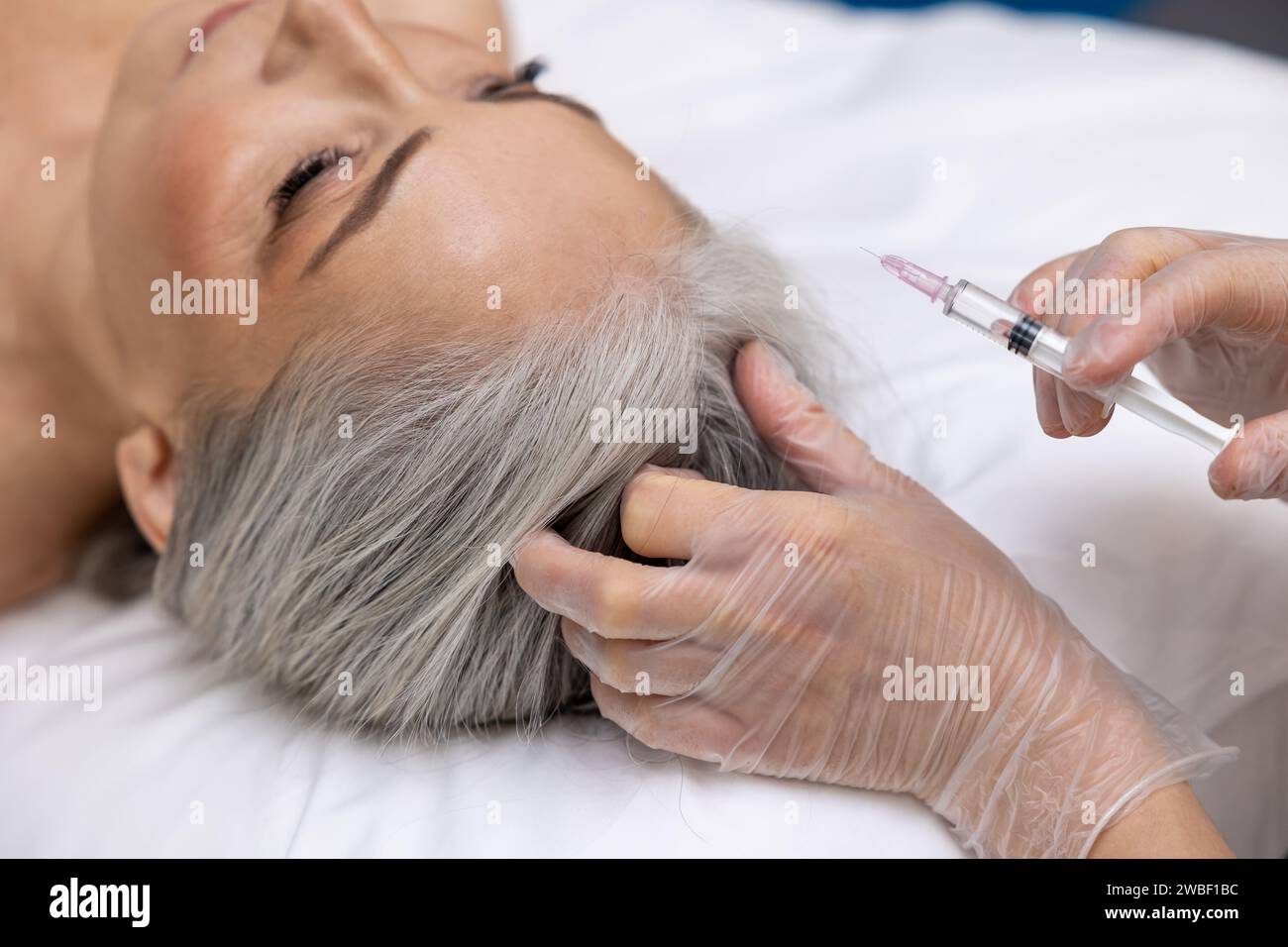 Dermal filler injections hi-res stock photography and images - Alamy