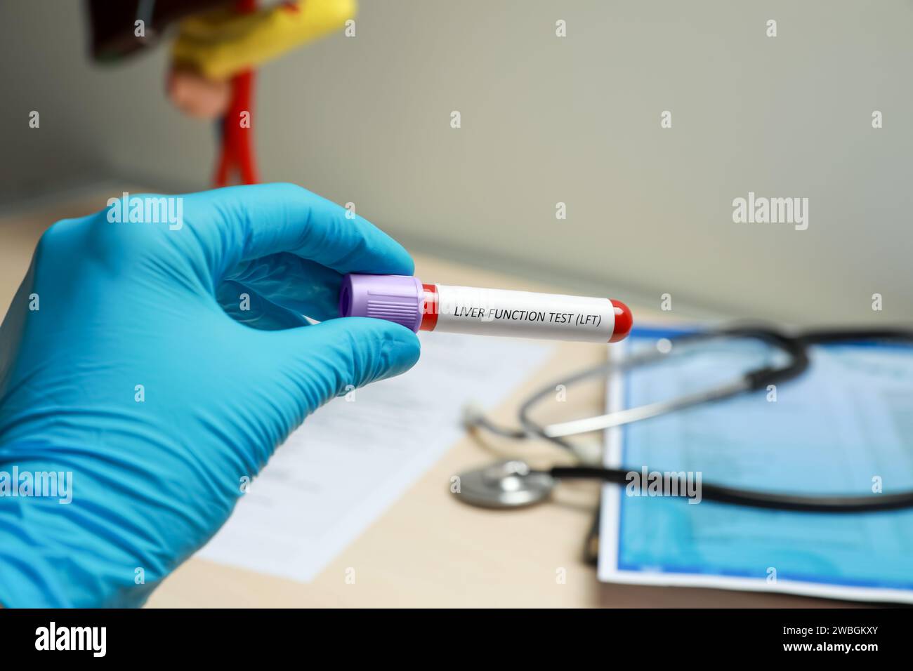 Laboratory worker holding tube with blood sample and label Liver ...
