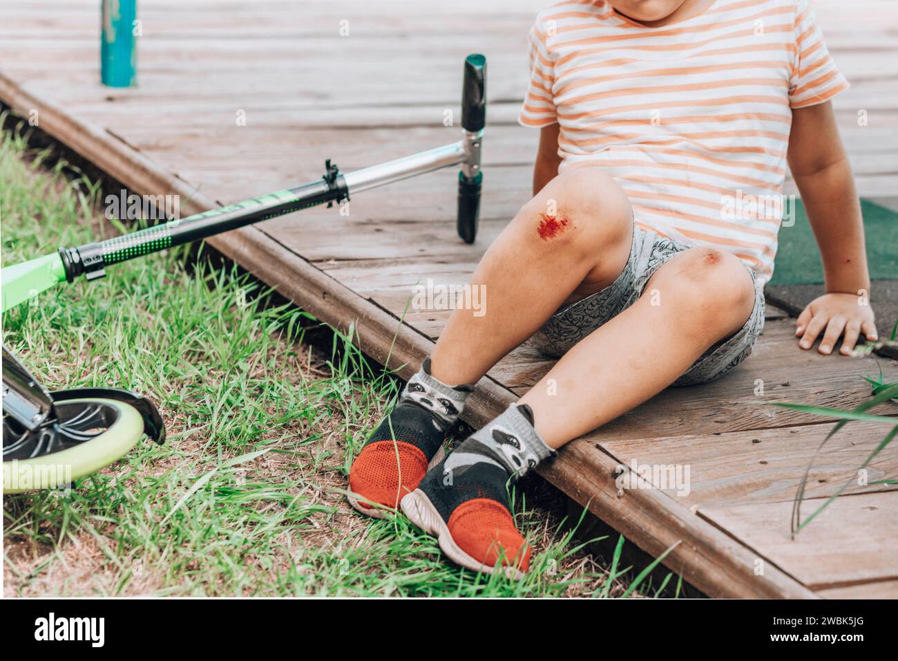 A close-up of a child's leg injury. The child injured his knee when he ...