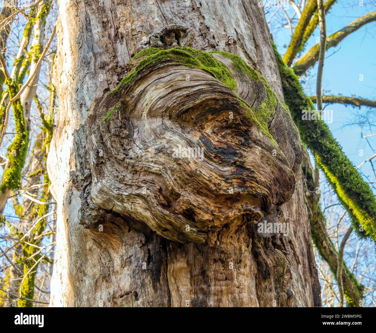 Tumor development hi-res stock photography and images - Alamy