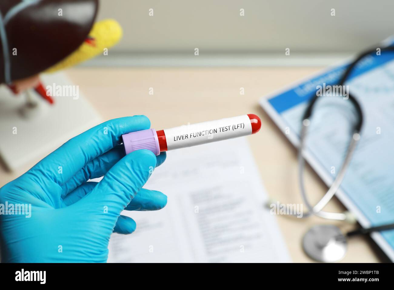 Laboratory worker holding tube with blood sample and label Liver ...