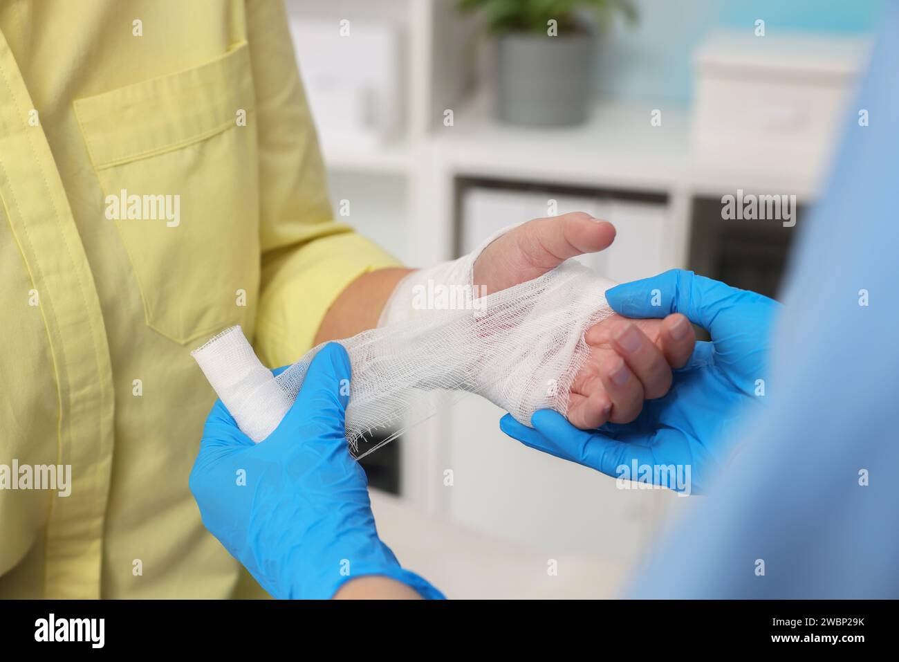 Doctor bandaging patient's burned hand in hospital, closeup Stock Photo ...
