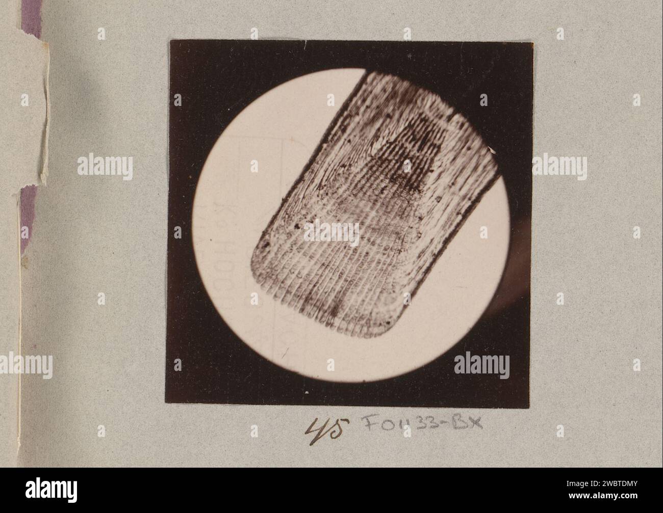 Microscopic recording of the scale of a tongue, 25 times enlarged ...