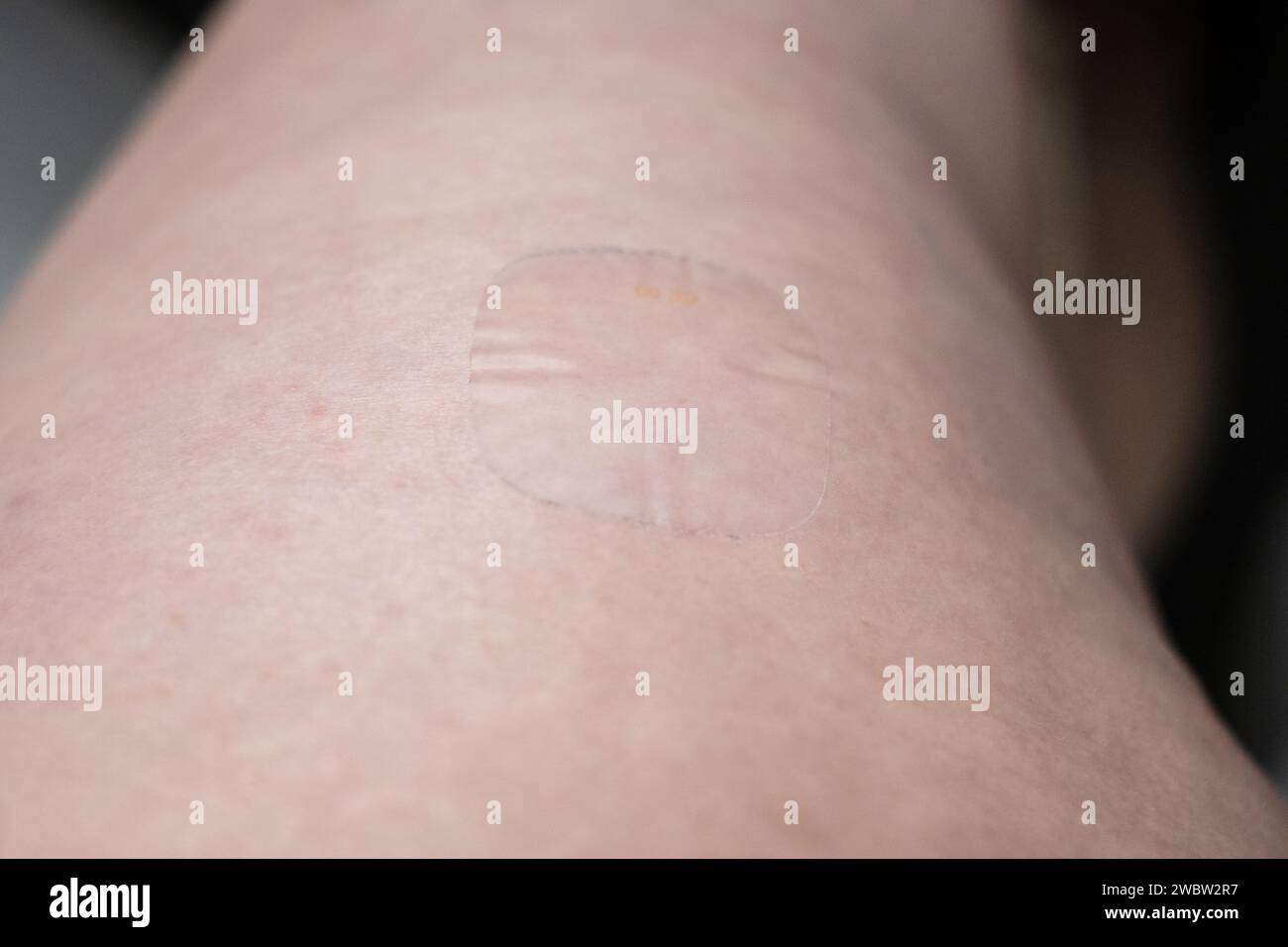 Hormone Replacement Therapy medication: self portrait looking down at ...