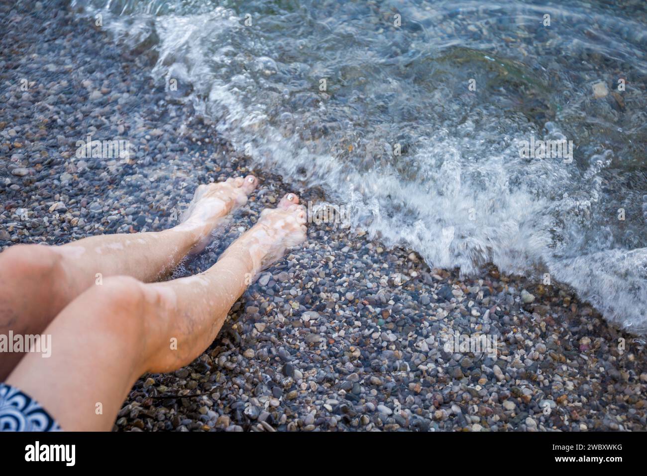 Vitiligo skin condition hi-res stock photography and images - Alamy