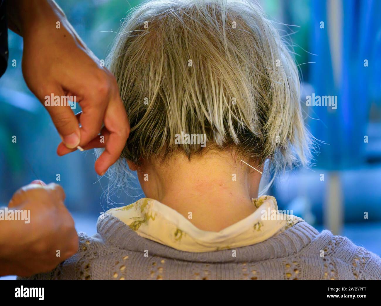 Senior woman receiving acupuncture treatment with one needle on her ...