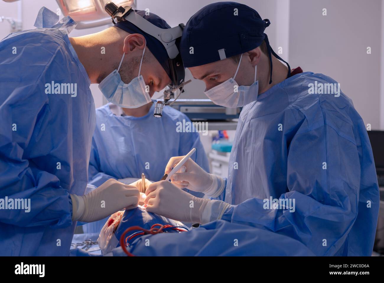 Blepharoplasty, plastic surgery operation for correcting defects ...