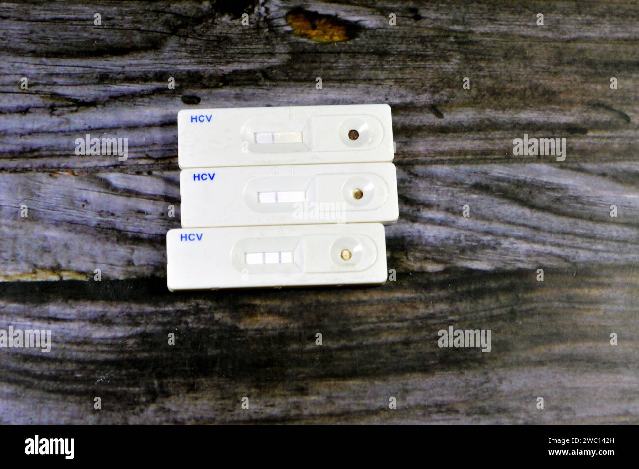 Positive and negative results of HCV blood sample rapid screening test ...