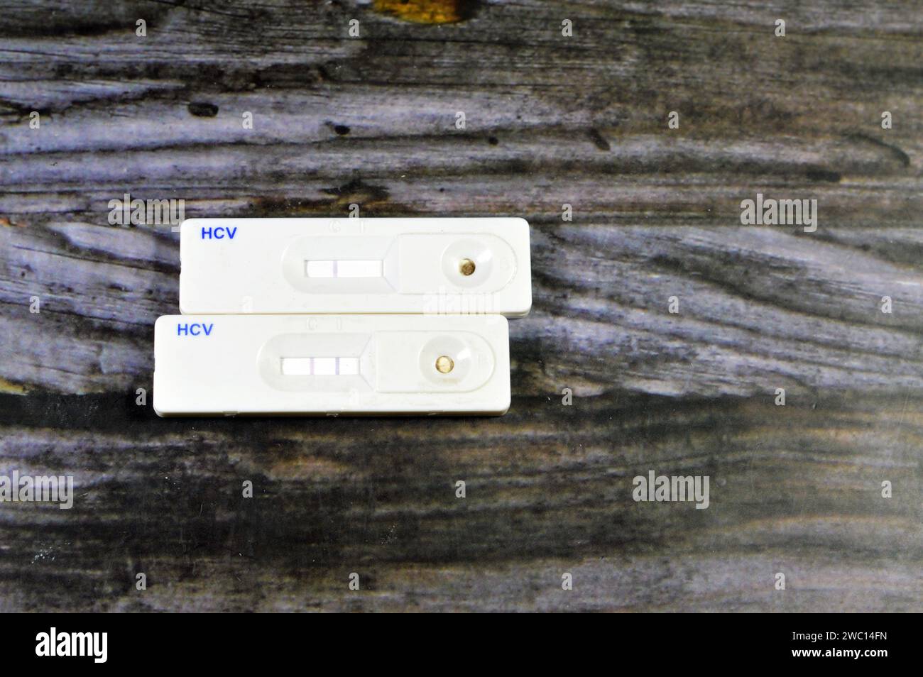 Positive and negative results of HCV blood sample rapid screening test ...