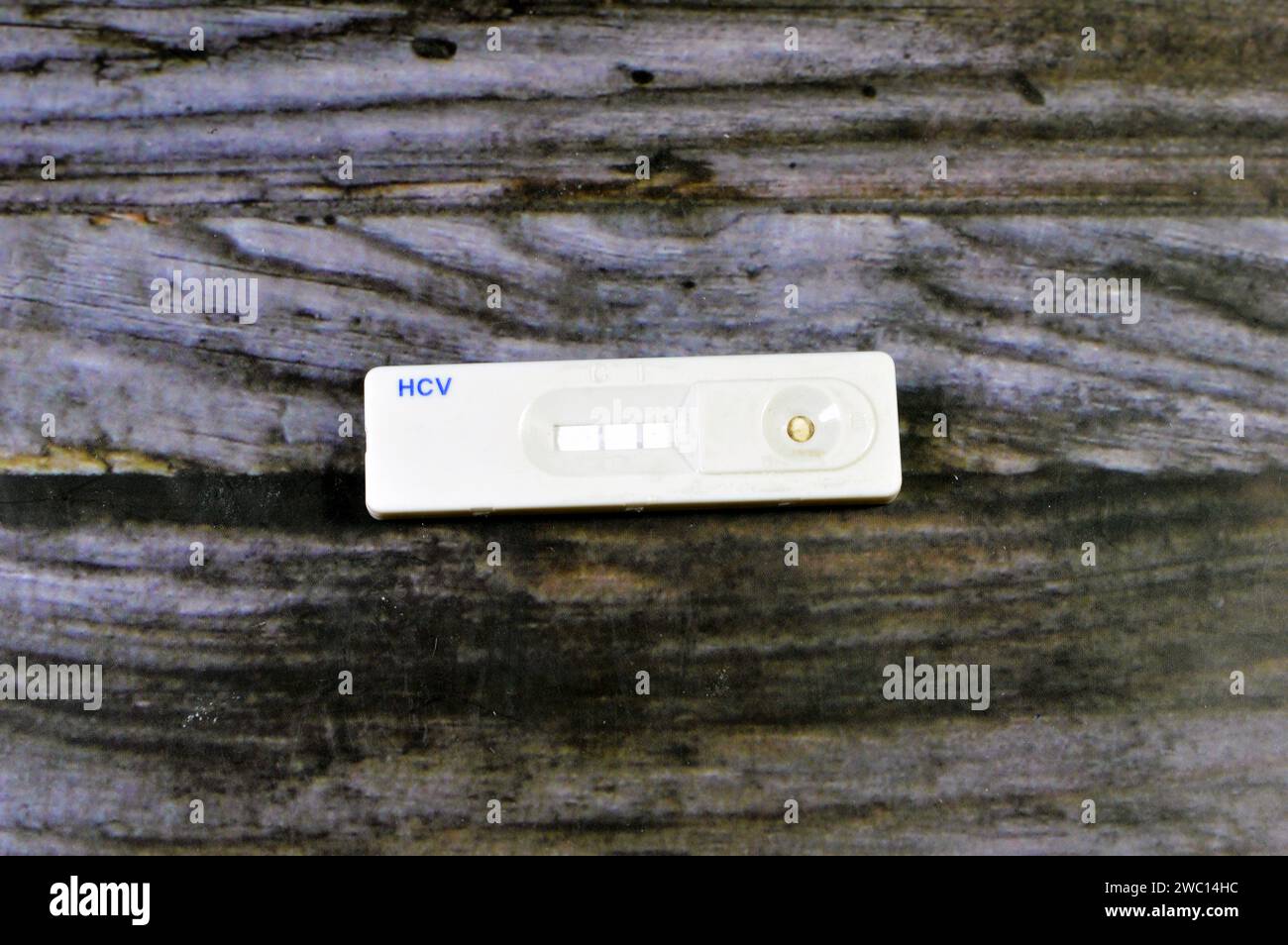 A positive test result of HCV blood sample rapid screening test ...