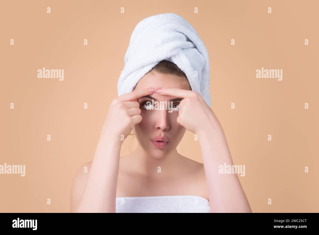 Woman squeeze out pimples on forehead. Acne and pimple on skin ...