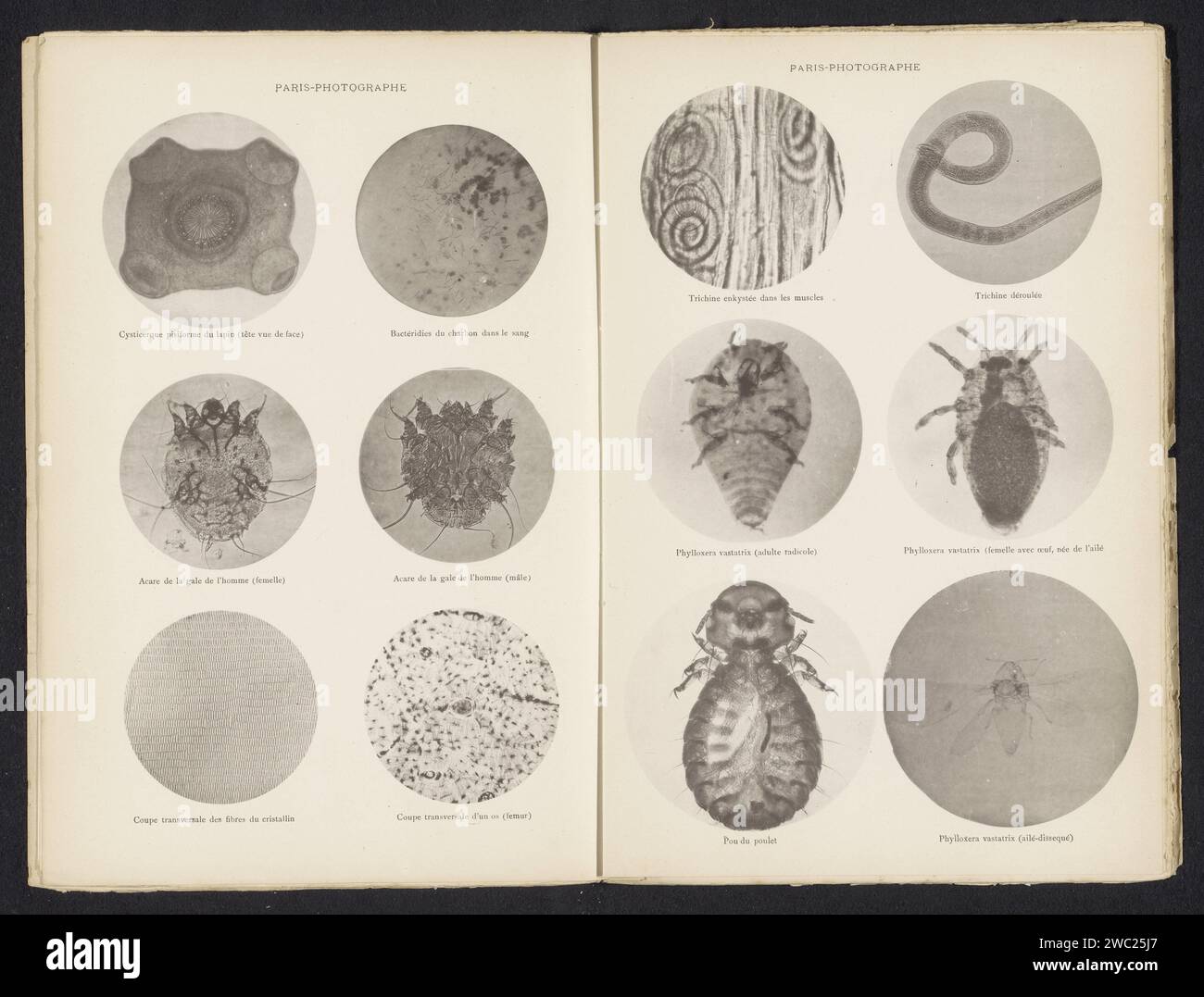 Overview of microscopic magnifications, c. 1881 - In or Before 1891 ...
