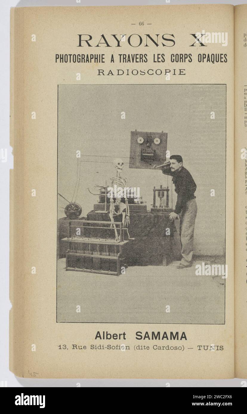 Albert Samama looks at a skeleton with an X -ray set, Albert Samama ...