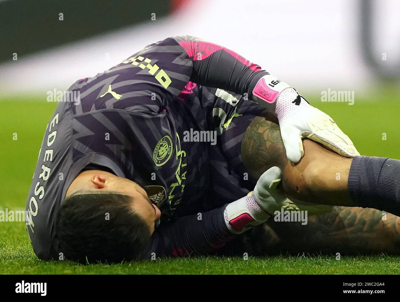 Manchester City goalkeeper Ederson reacts to an injury during the ...