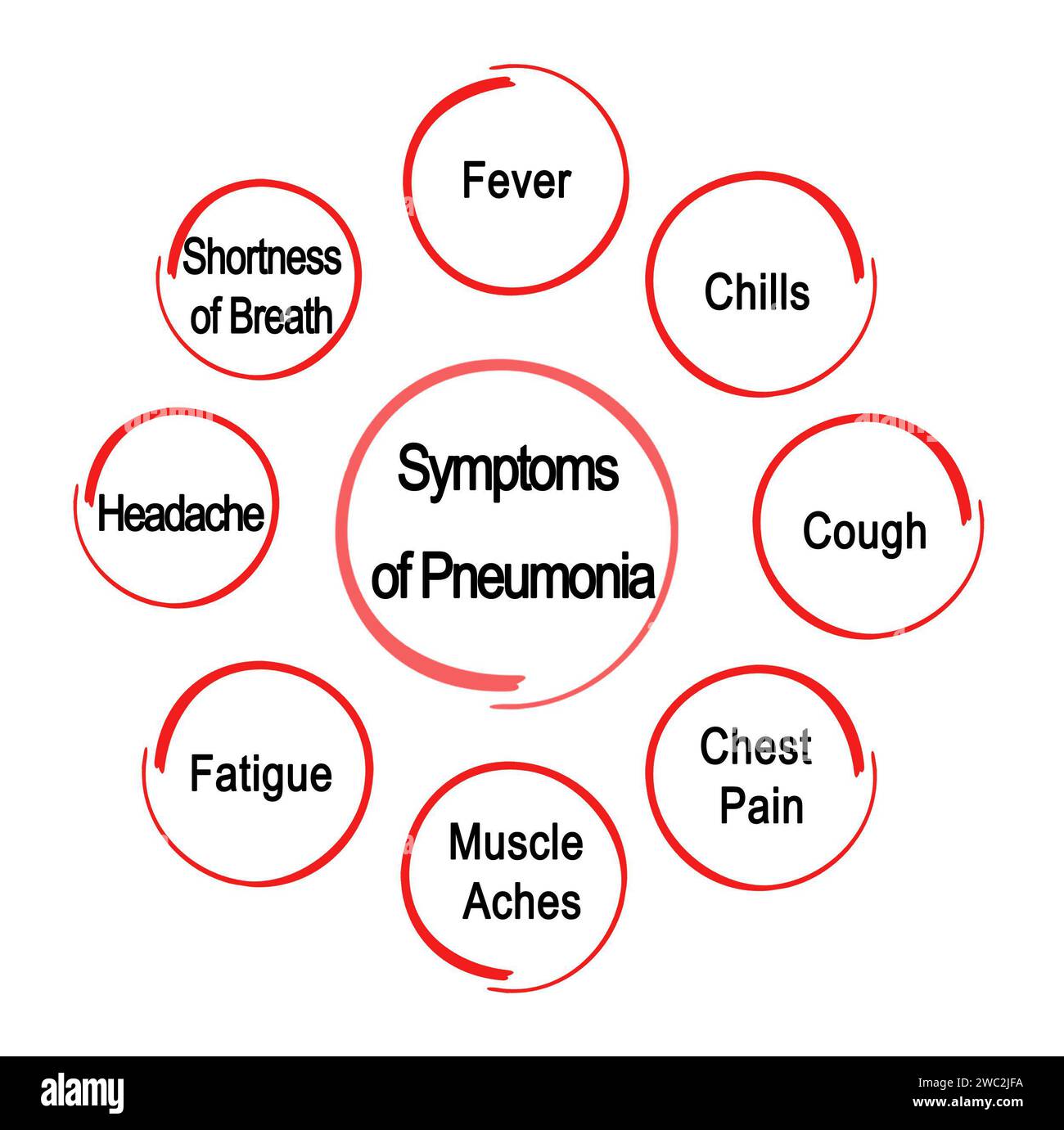 Eight Symptoms of Pneumonia Stock Photo - Alamy