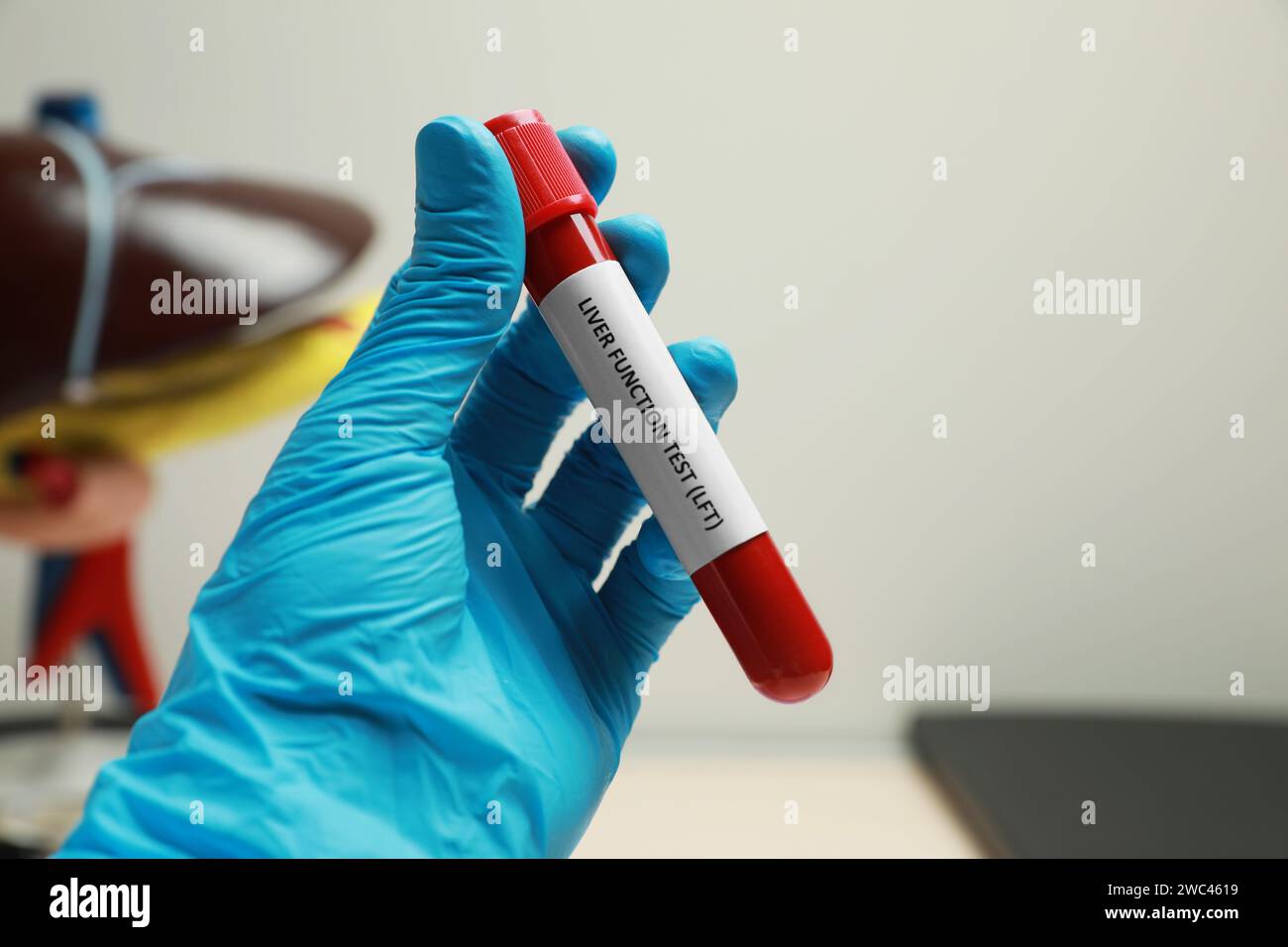 Laboratory worker holding tube with blood sample and label Liver ...