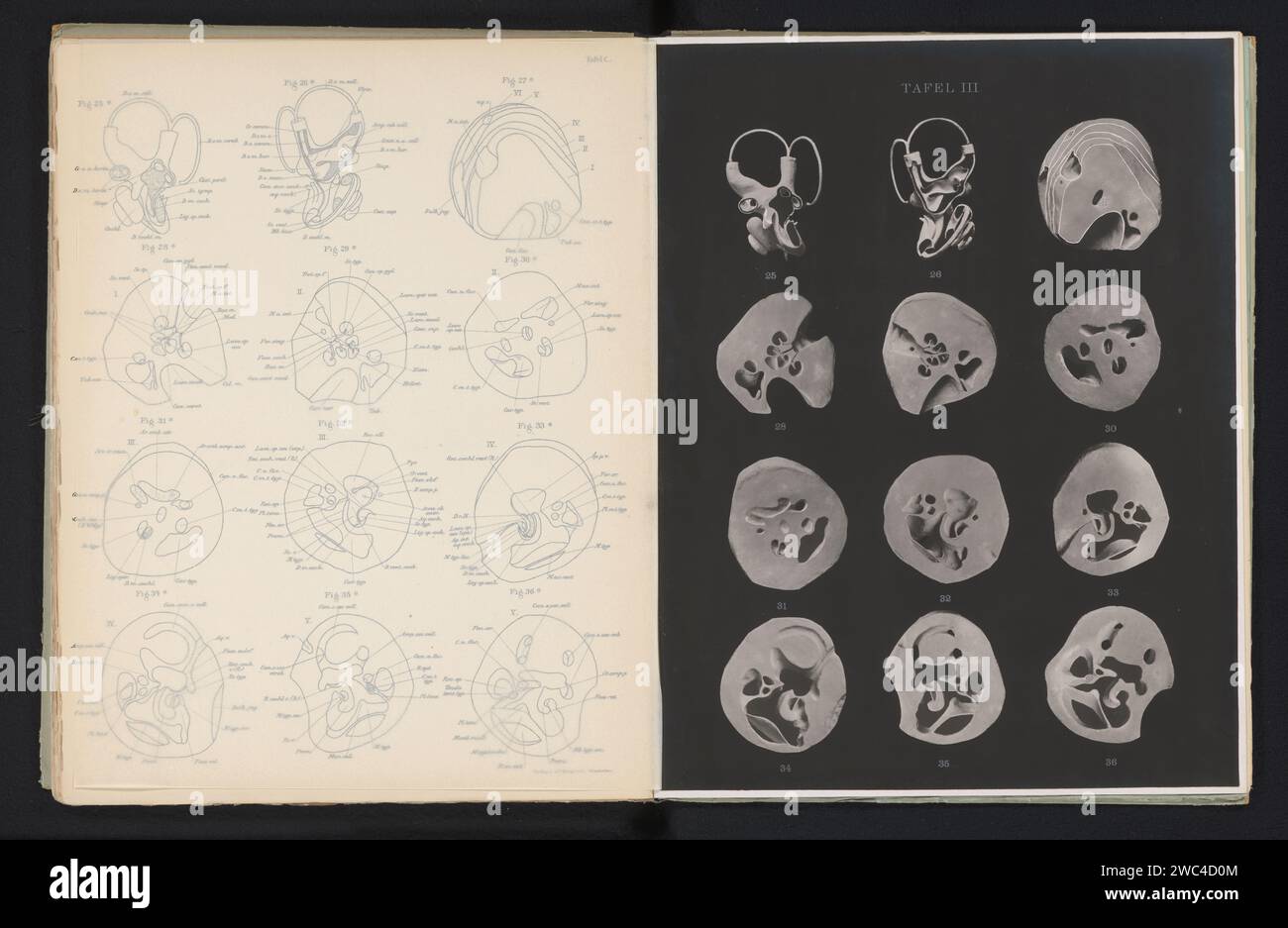 Twelve models of the human hearing organ, Adolf Schönemann, 1904 ...
