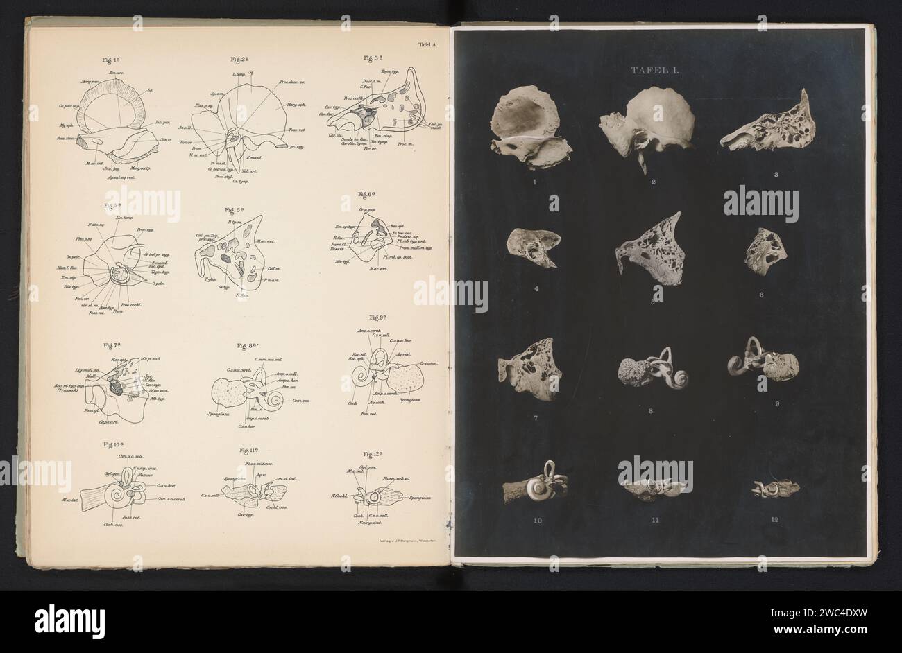 Twelve preparations and casts of the human hearing organ and the ear ...