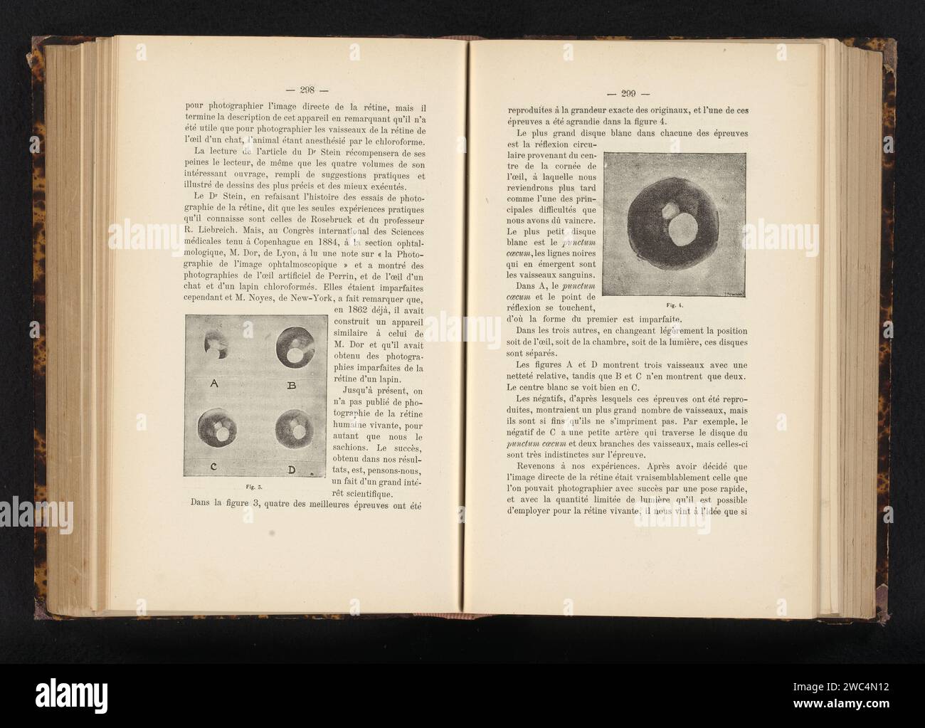 Microscopic recordings of the human eye, William Thomas Jackman, 1885 ...
