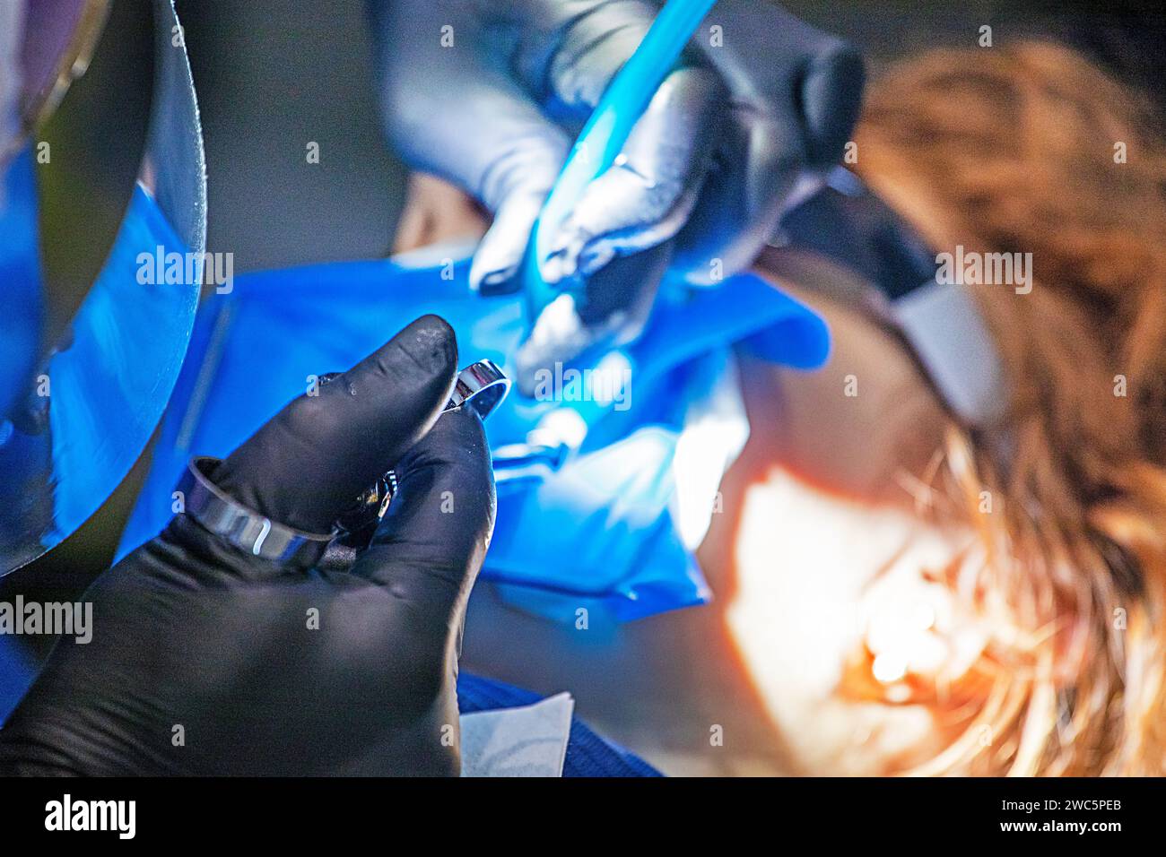 Dentist fixes patient's diseased tooth with instruments Stock Photo - Alamy