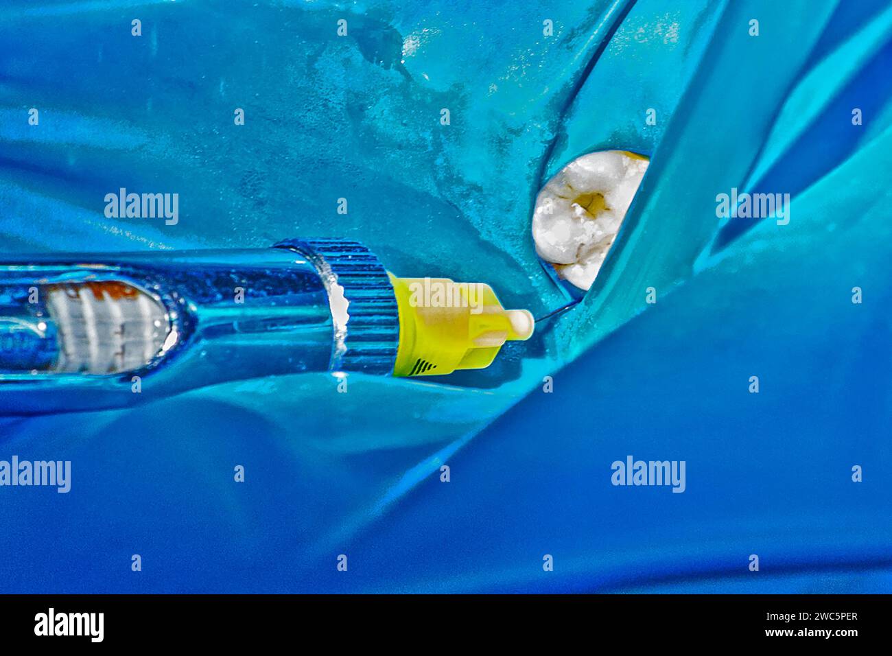 give an injection of anesthesia to a sick woman before his treatment ...