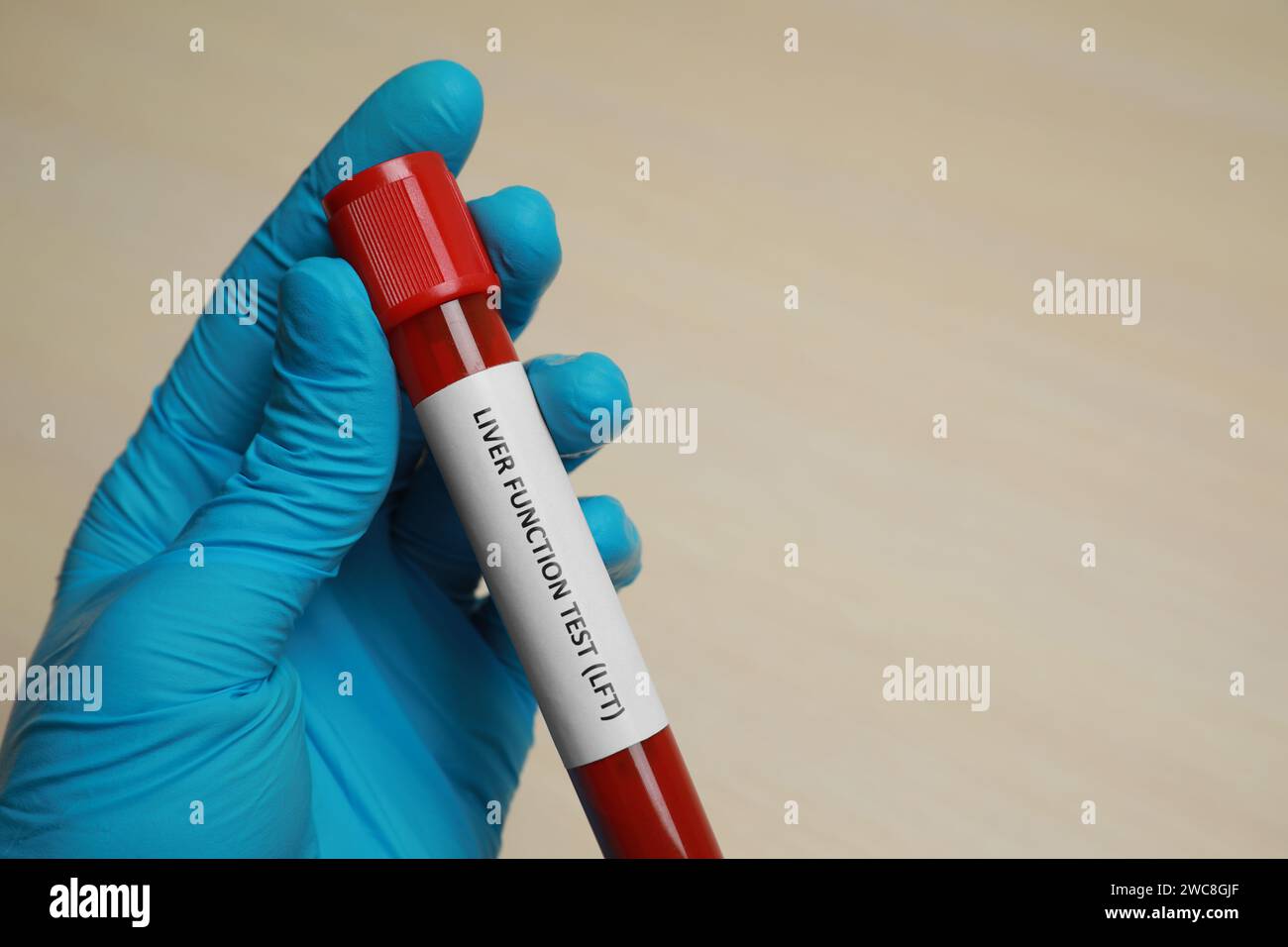 Laboratory worker holding tube with blood sample and label Liver ...