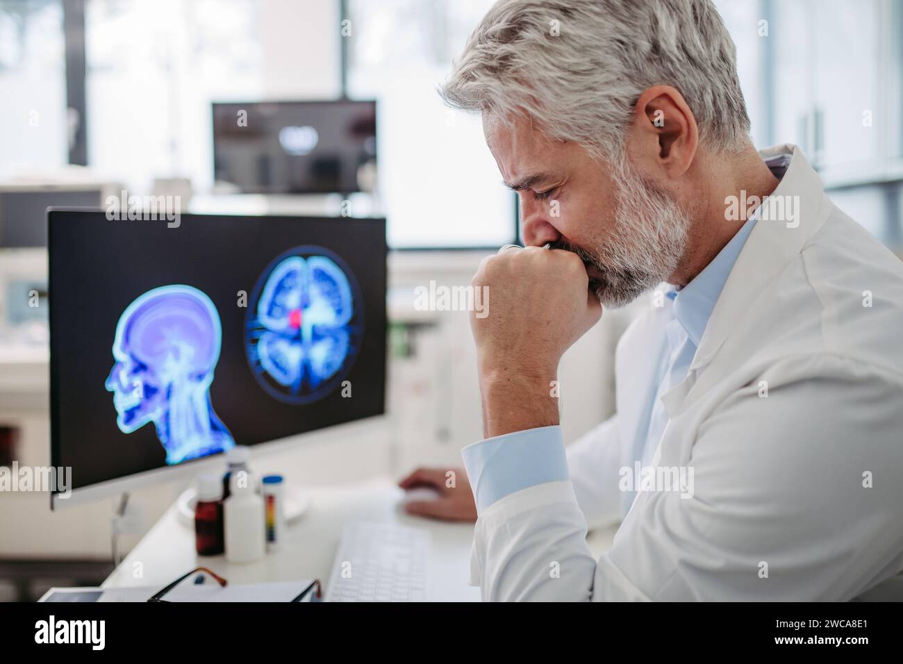 Sad doctor looks at an MRI scan, patient's bad test results, feeling ...