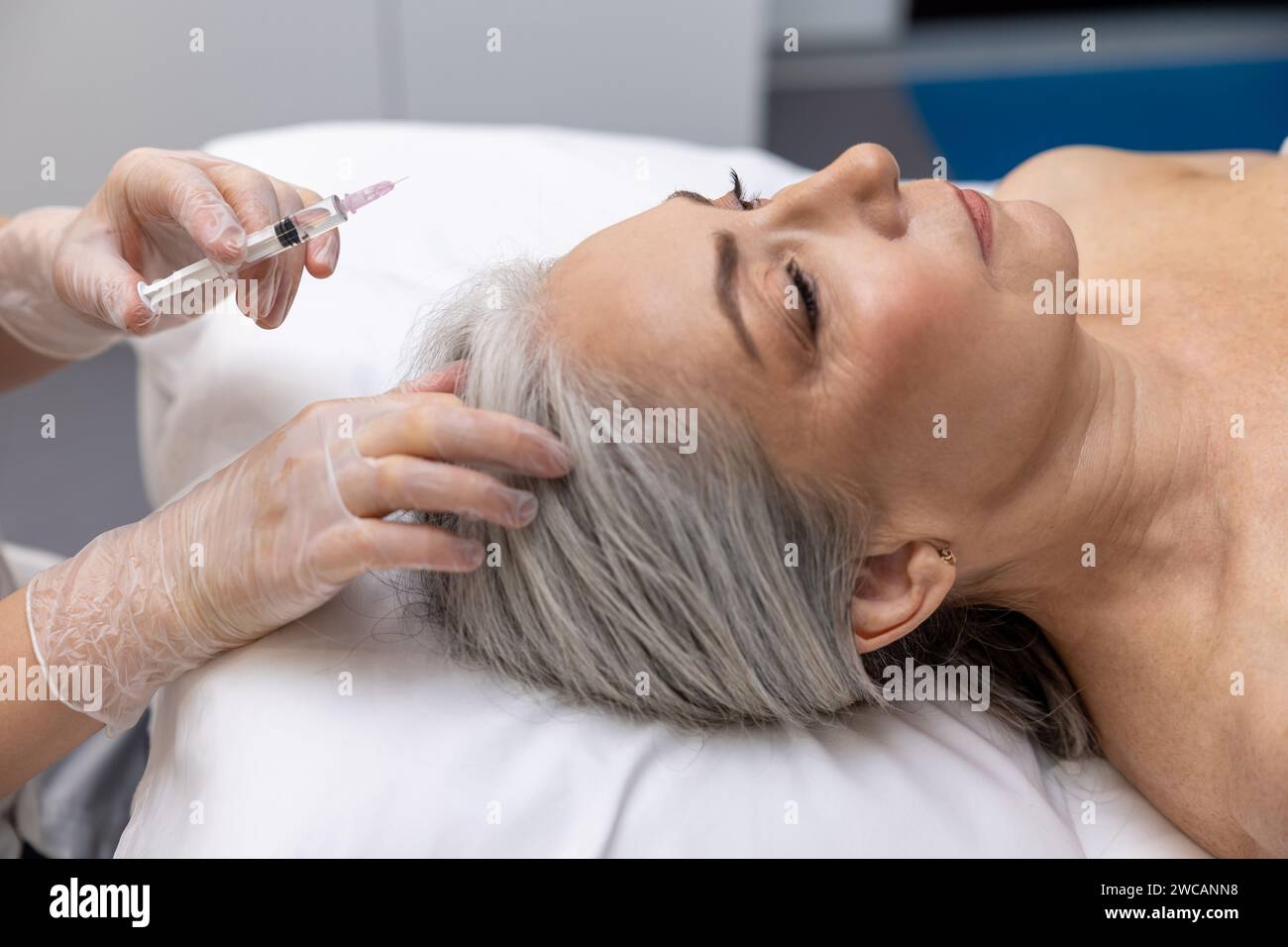Dermal filler injections hi-res stock photography and images - Alamy