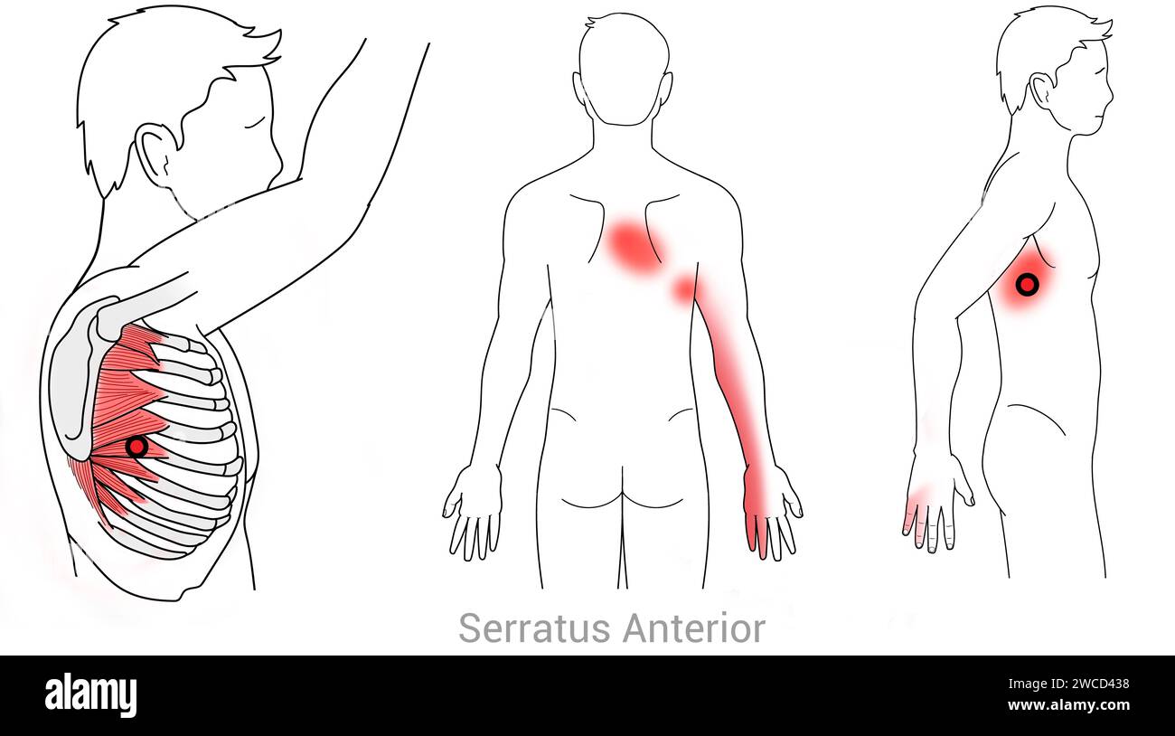 Upper arm pain hi-res stock photography and images - Alamy