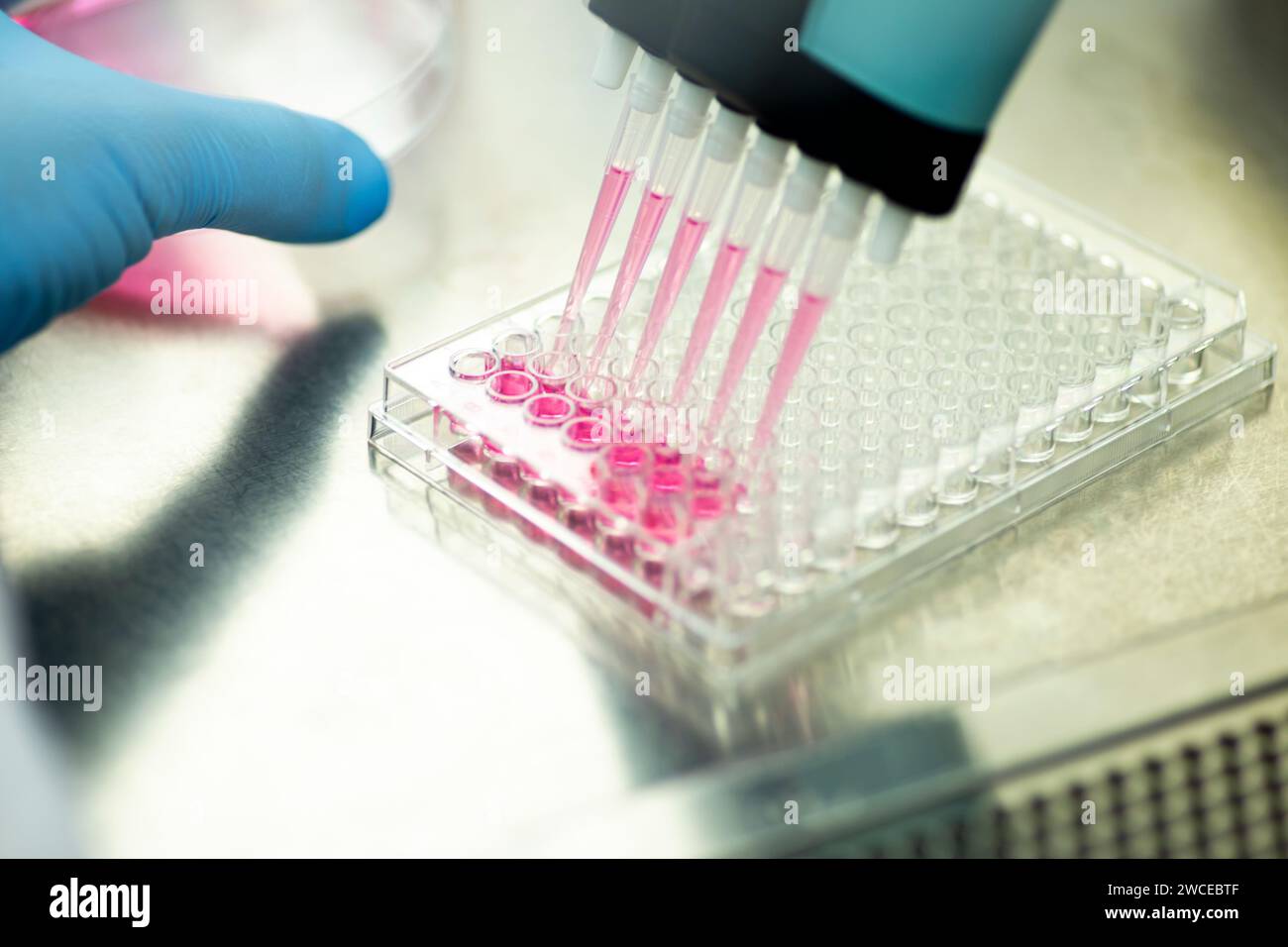cell culture at the medicine, medical and cell culture laboratory ...