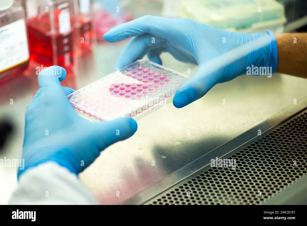 cell culture at the medicine, medical and cell culture laboratory ...