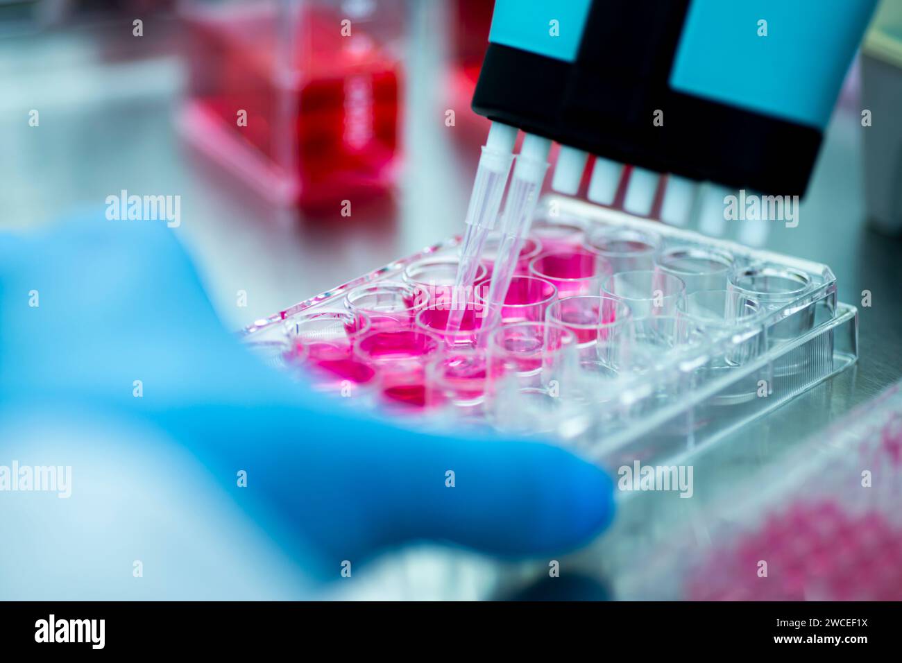 cell culture at the medicine, medical and cell culture laboratory ...