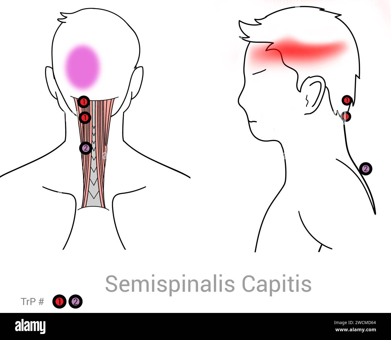 Semispinalis capitis Cut Out Stock Images & Pictures - Alamy